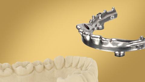 NobelProcera® Scan and Design Services | Nobel Biocare United States