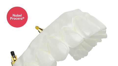 NobelProcera® Zirconia Implant Bridge | Nobel Biocare