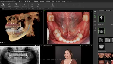 DTX Studio™ Clinic │Nobel Biocare